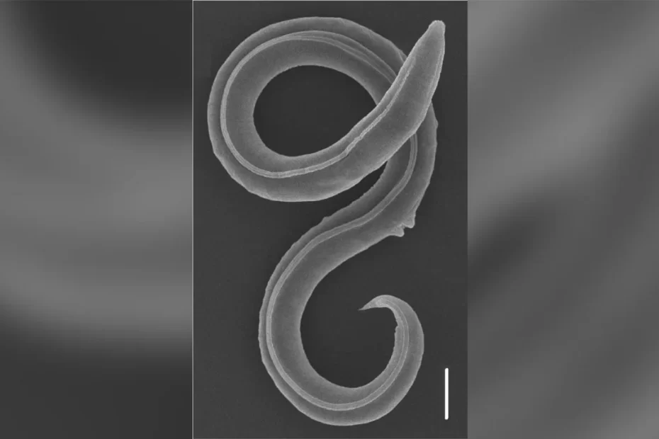 How a 46,000-year-old Worm Found in Siberian Permafrost Was Brought ...